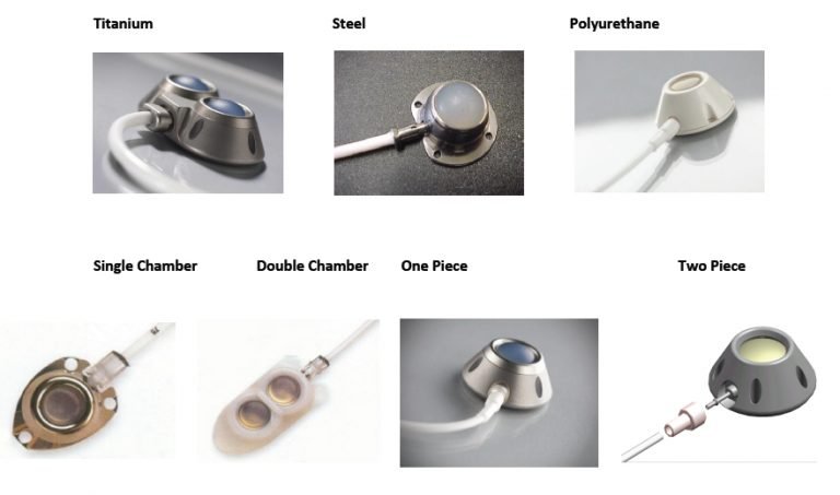 Chemoports: Toll Roads in Cancer Treatment